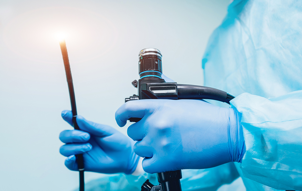 Everything you need to know about endoscopy - Gray's Endoscopy